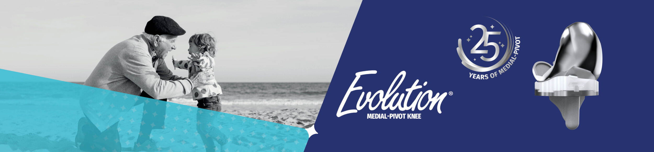 Medial-Pivot Knee Implant ⋆ Joint Academy Microport