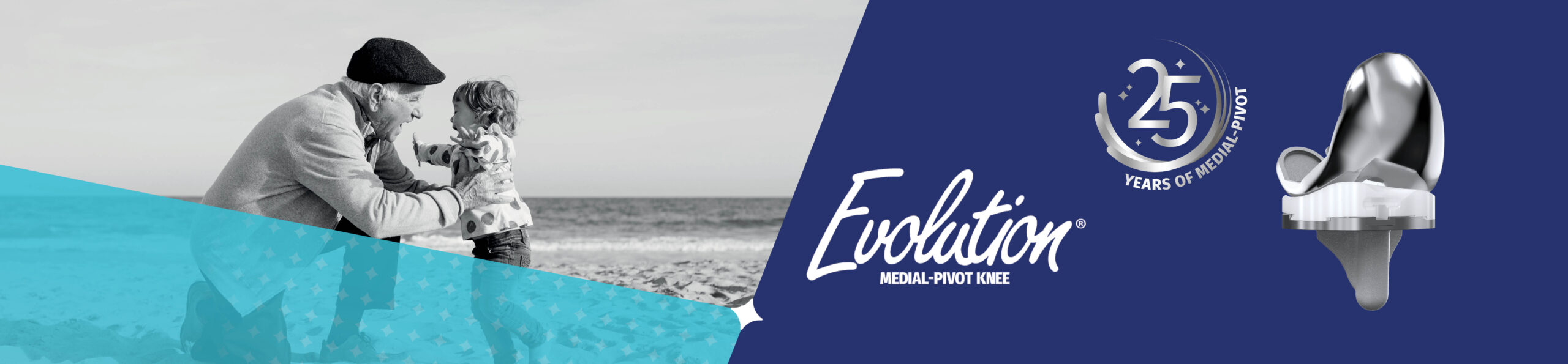 Medial-Pivot Knee Implant ⋆ Joint Academy Microport