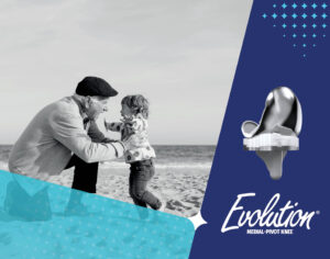 Medial-Pivot Knee Implant ⋆ Joint Academy Microport