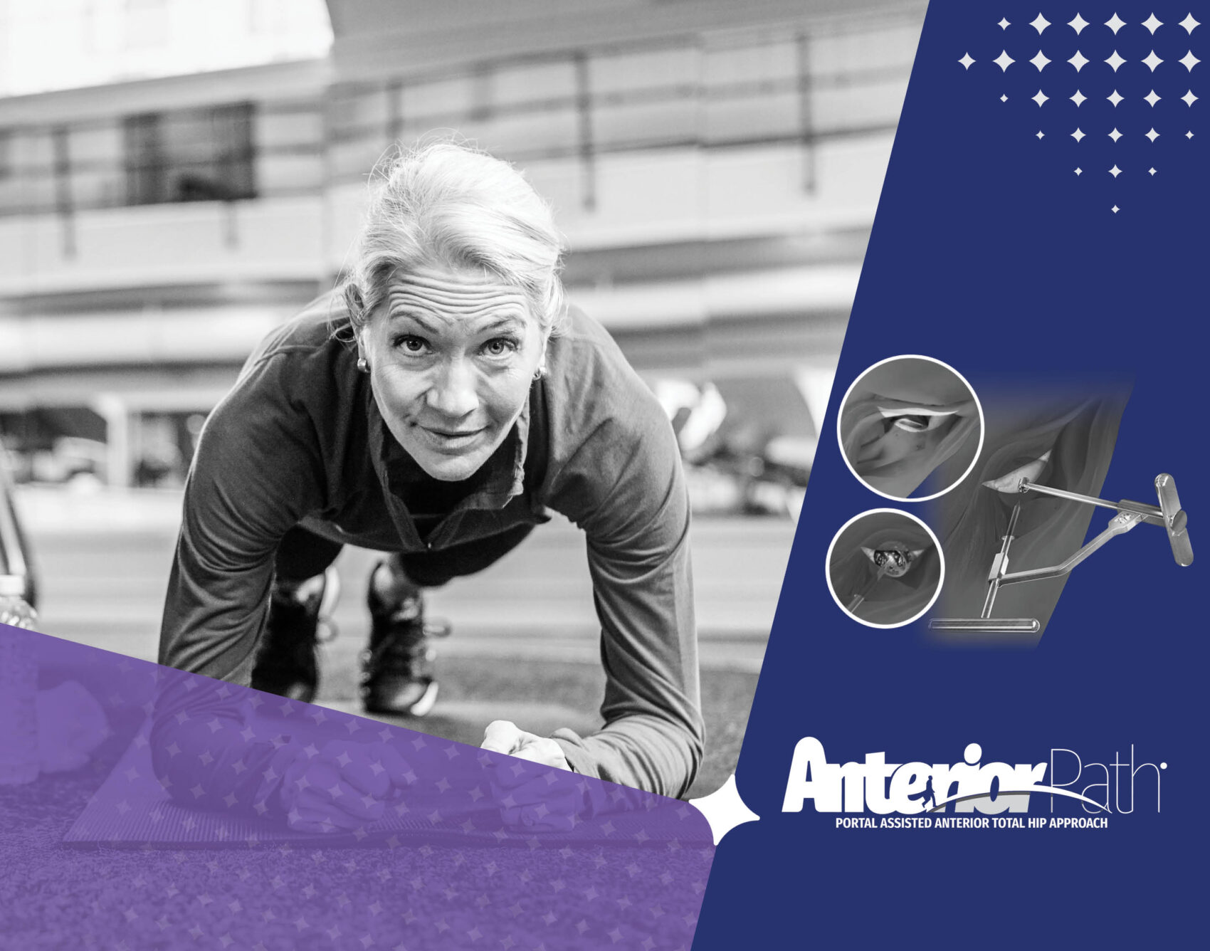 Microport Products ⋆ Joint Academy Microport